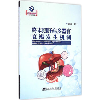 终末期肝病多器官衰竭发生机制