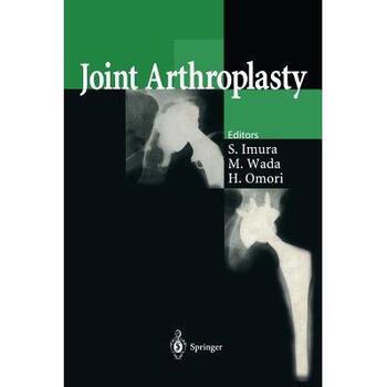 Joint Arthroplasty