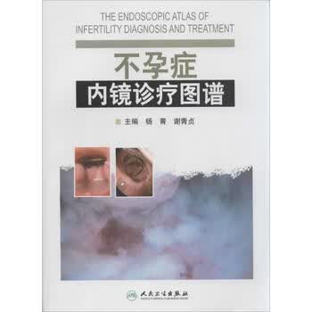 不孕症内镜诊疗图谱