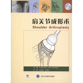 肩关节成形术