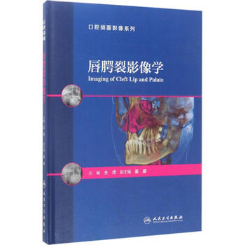 唇腭裂影像学