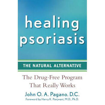 Healing Psoriasis: The Natural Alternative