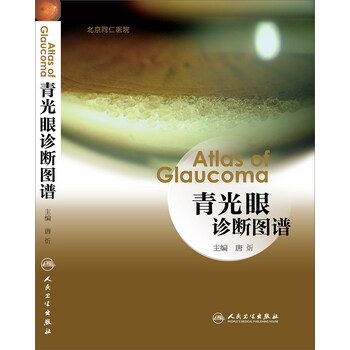 青光眼诊断图谱