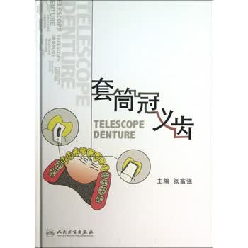 套筒冠义齿(精)