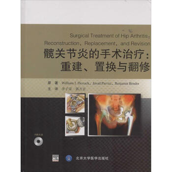 髋关节炎的手术治疗
