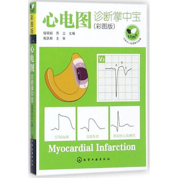 心电图诊断掌中宝(彩图版)