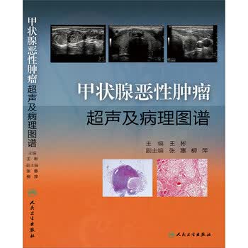 甲状腺恶性肿瘤超声及病理图谱