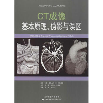 CT成像
