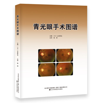 青光眼手术图谱 医学 书籍