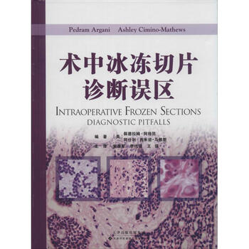 术中冰冻切片诊断误区