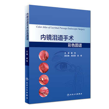 [正版图书]内镜泪道手术彩色图谱