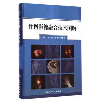 骨科影像融合技术图解(精)