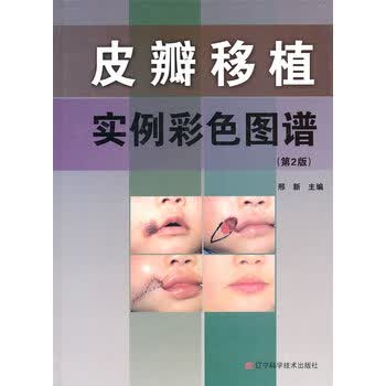 皮瓣移植实例彩色图谱（第2版） 书籍 医学 皮肤病学与学