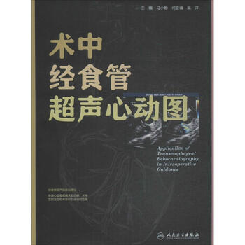 术中经食管超声心动图