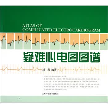 疑难心电图图谱