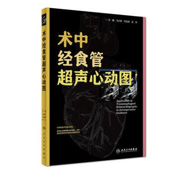 术中经食管超声心动图