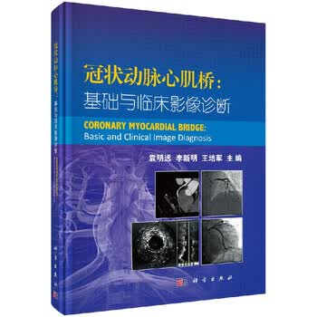 冠状动脉心肌桥：基础与临床影像诊断