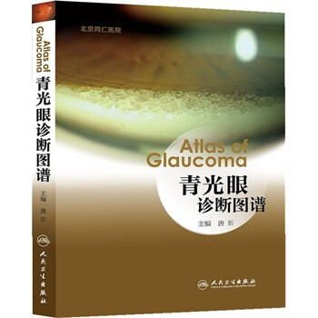 青光眼诊断图谱