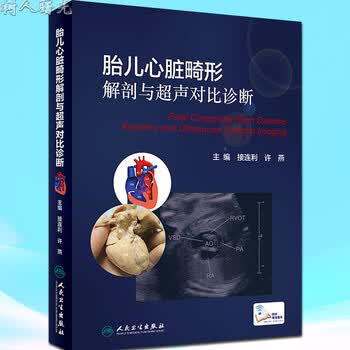 胎儿心脏畸形解剖与超声对比诊断(配增值)