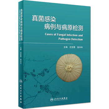 真菌感染病例与病原检测