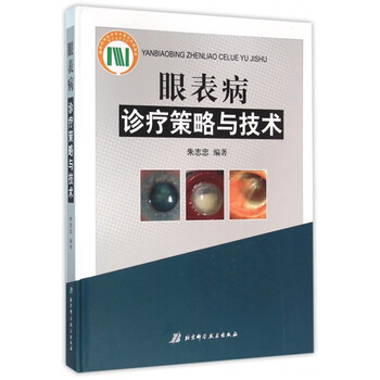 眼表病诊疗策略与技术(精)