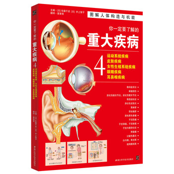 你一定要了解的重大疾病4：运动系统疾病、皮肤疾病、女性生殖系统疾病、眼睛疾病、耳鼻喉疾病