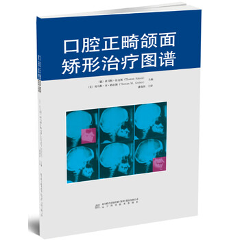 口腔正畸颌面矫形治疗图谱
