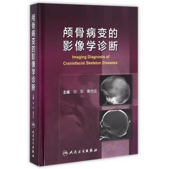 颅骨病变的影像学诊断(精)