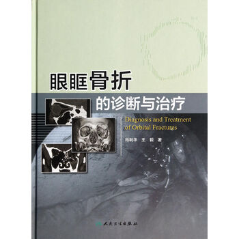 眼眶骨折的诊断与治疗(精)