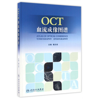 OCT血流成像图谱(精)