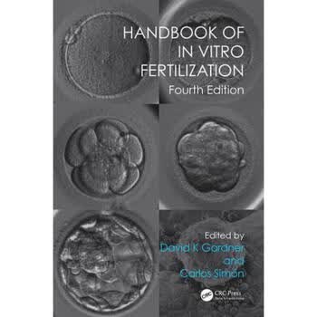Handbook of in Vitro Fertilization