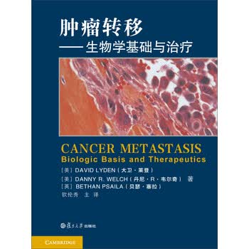 [正版图书]肿瘤转移：生物学基础及治疗